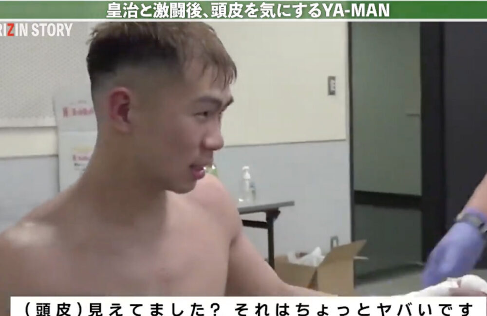 格闘家・ya-man(ヤーマン)の頭はハゲてる？髪画像まとめ！